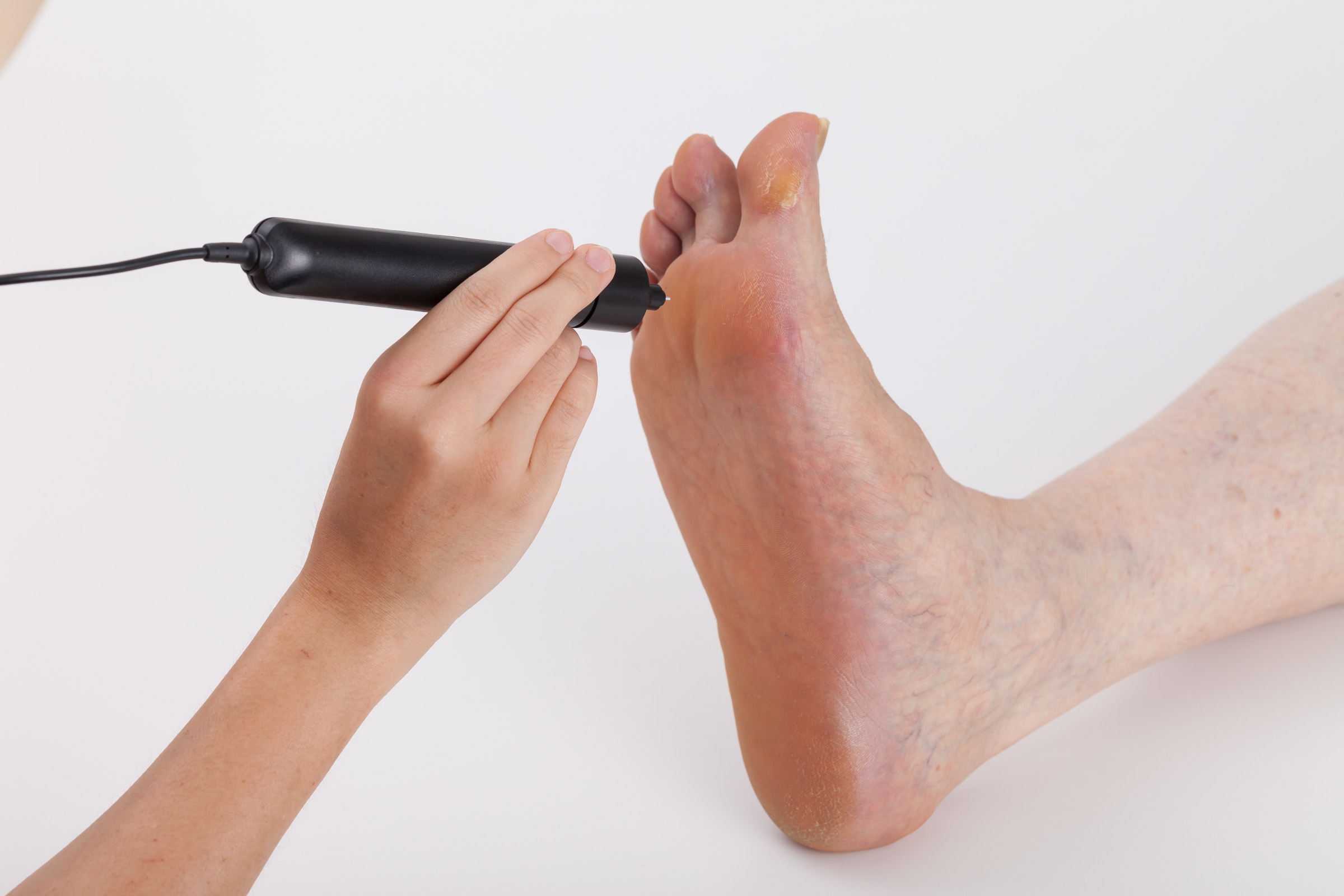 皮膚・頭皮の硬度計測計Indentometer IDM800 | 株式会社インテグラル